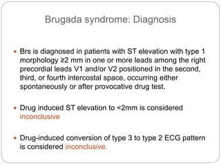 Brugada Syndrome by Abhishek Rathore MD DM | PPT