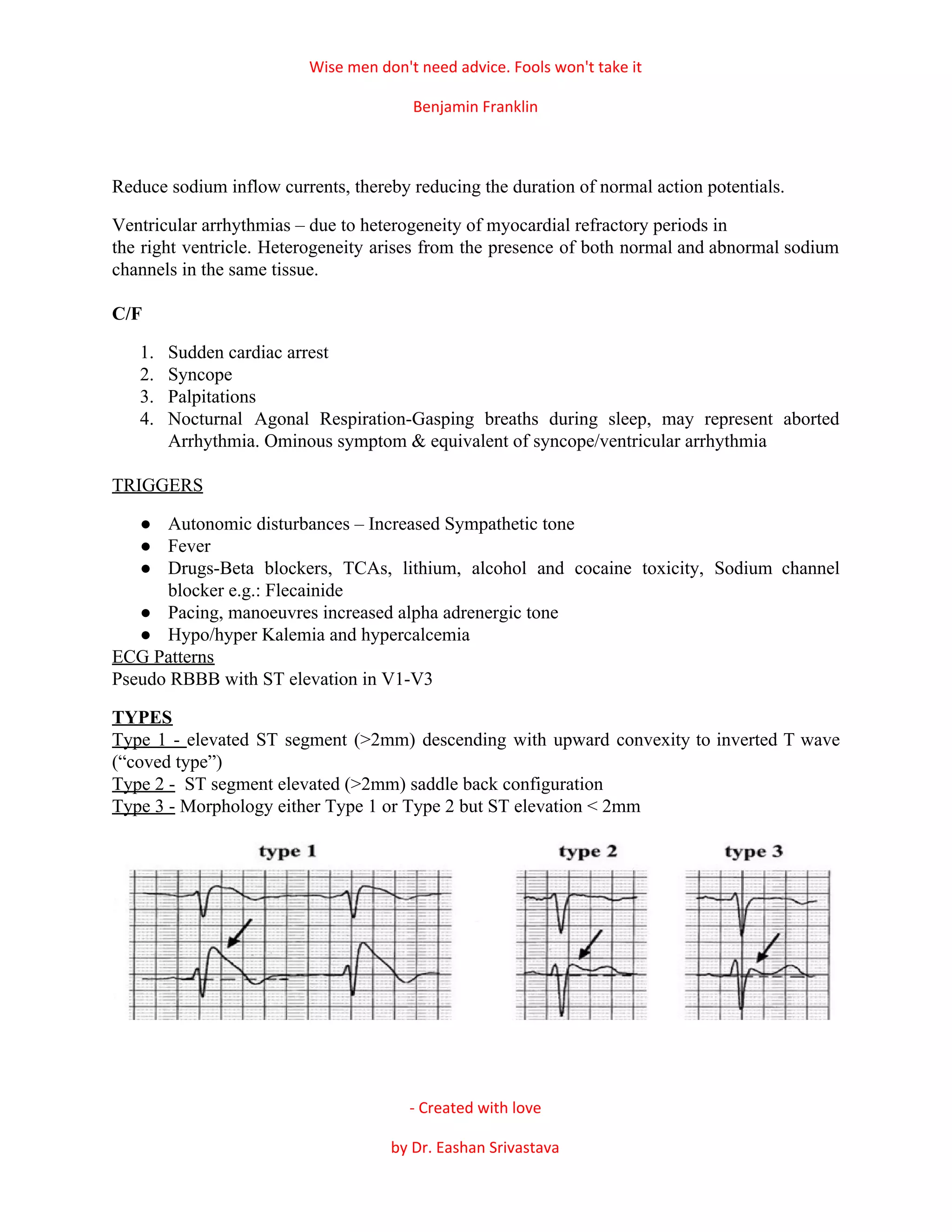 Brugada syndrome | PDF