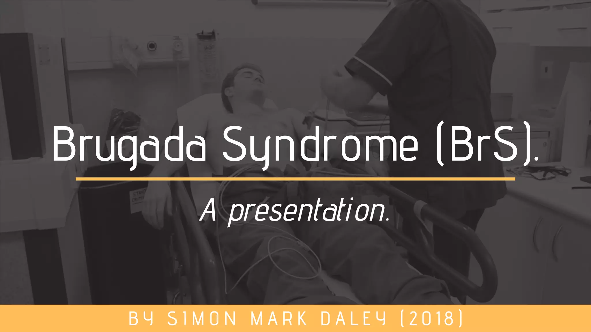 Brugada syndrome (BrS) | PDF