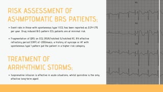 Brugada syndrome (BrS) | PDF