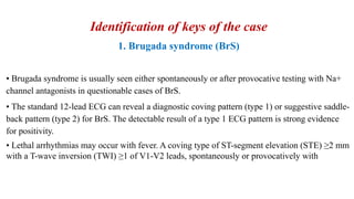 Brugada Syndrome in Pulmonary Embolism Extremely Rare Presentation.pptx
