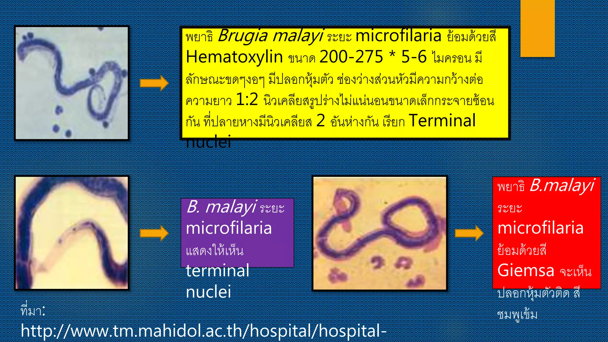 Brugia malayi | PPTX
