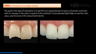 Evolution of Conservative Odontology | PPT