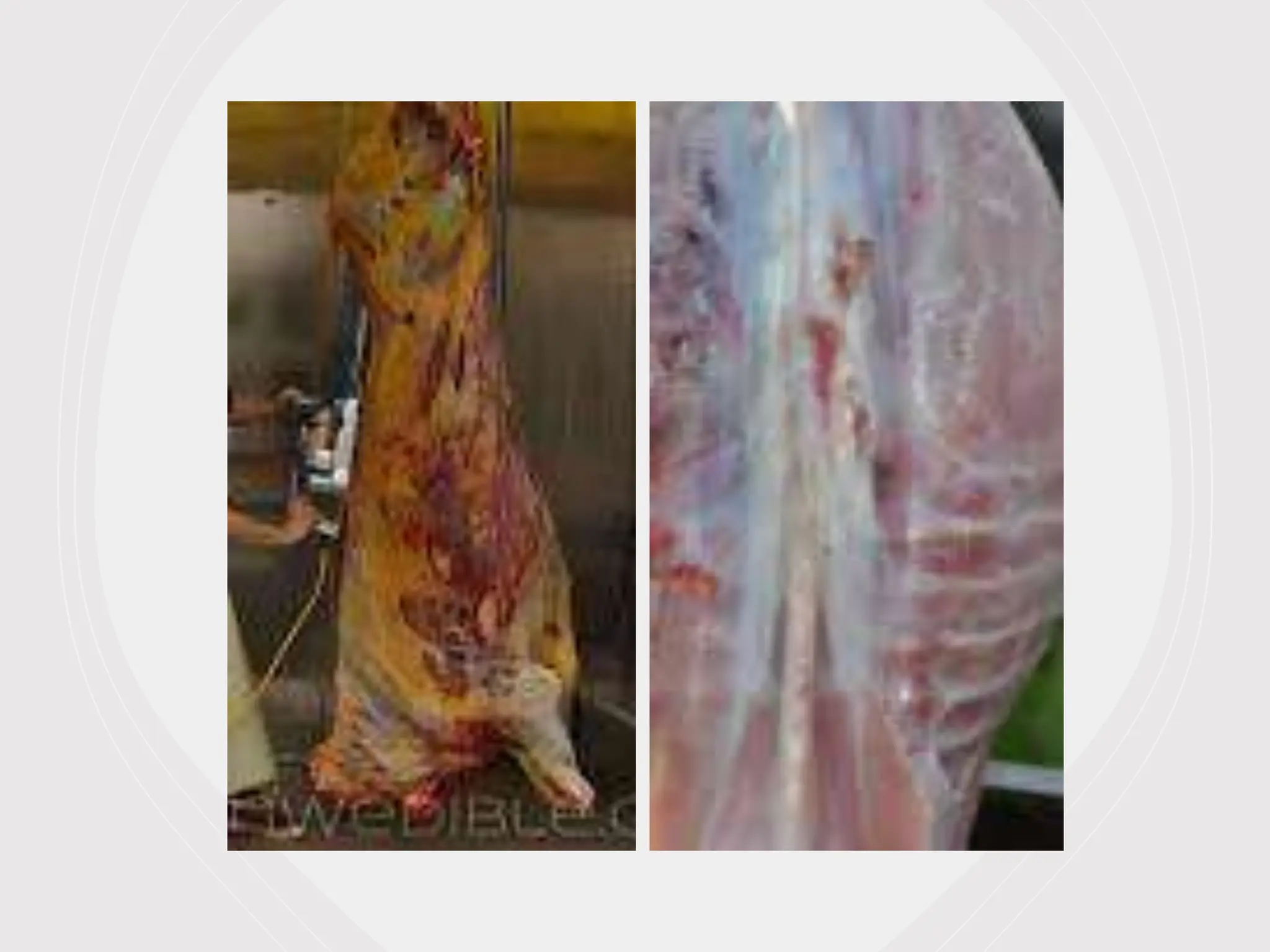 Subcutaneous wounds bruises and Contusions .pptx | First Aid | Injuries