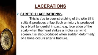 Bruises lacerations | PPTX