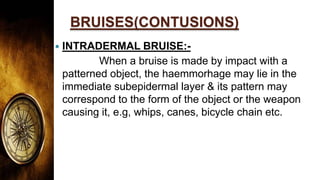 Bruises lacerations | PPTX