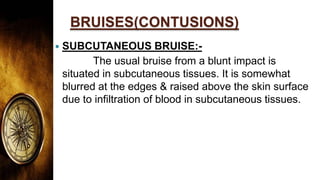 Bruises lacerations | PPTX