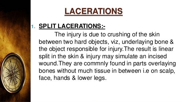 Bruises lacerations