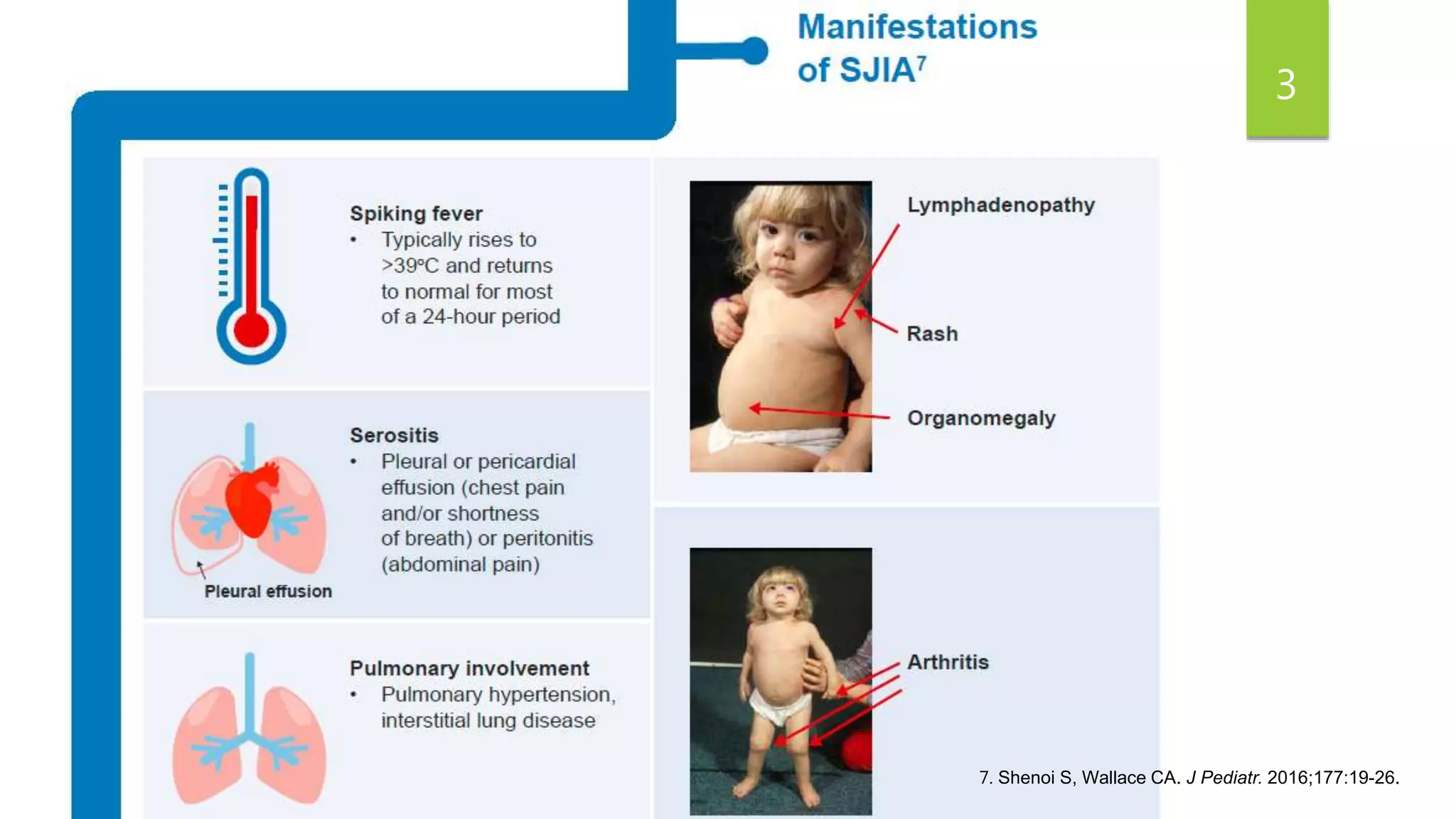What is SJIA - How is it different than other diseases - Dr. Hermine ...