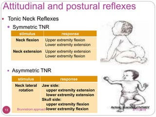 Tonic Lumbar Reflex