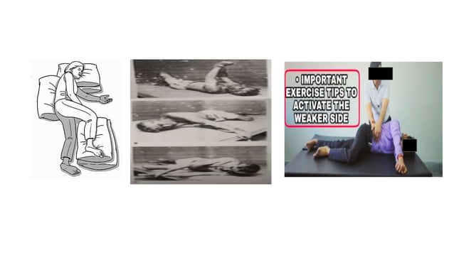 Brunnstrom Approach | PPT