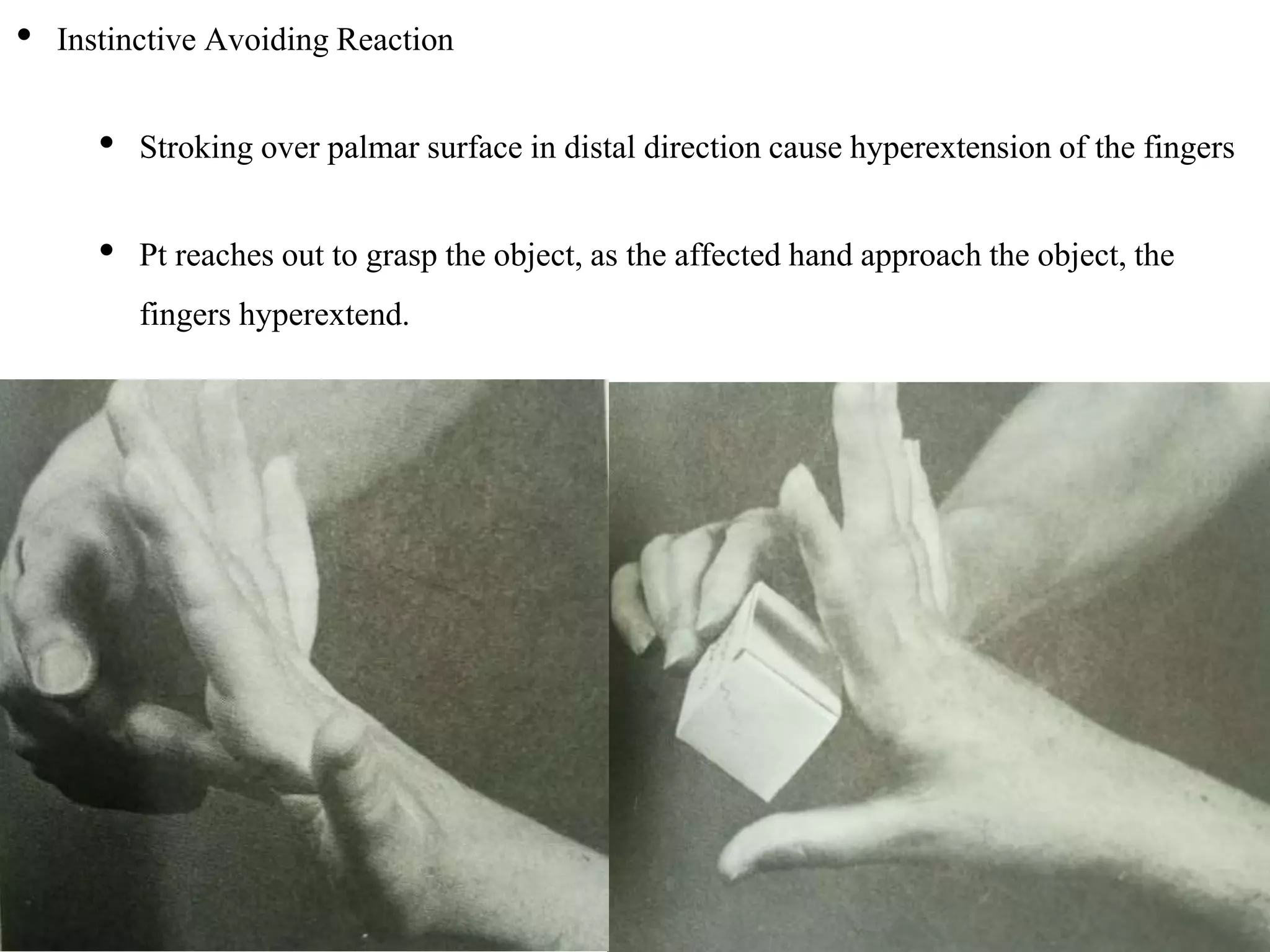 brunnstrom's approach ppt.pptx