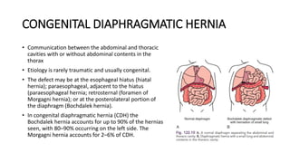 BRUNO Diaphragmatic Hernia.pptx