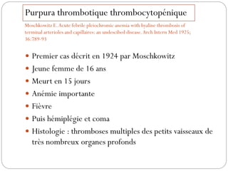 Histologie Du Purpura Thrombocytopénique Idiopathique