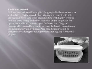 Brushing-techniques-for-general-and-periodontal-patients.pptx