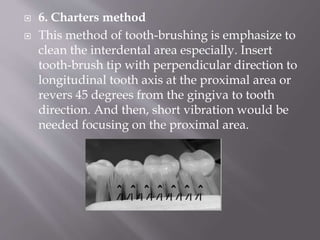 Brushing-techniques-for-general-and-periodontal-patients.pptx