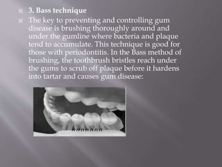 Brushing-techniques-for-general-and-periodontal-patients.pptx