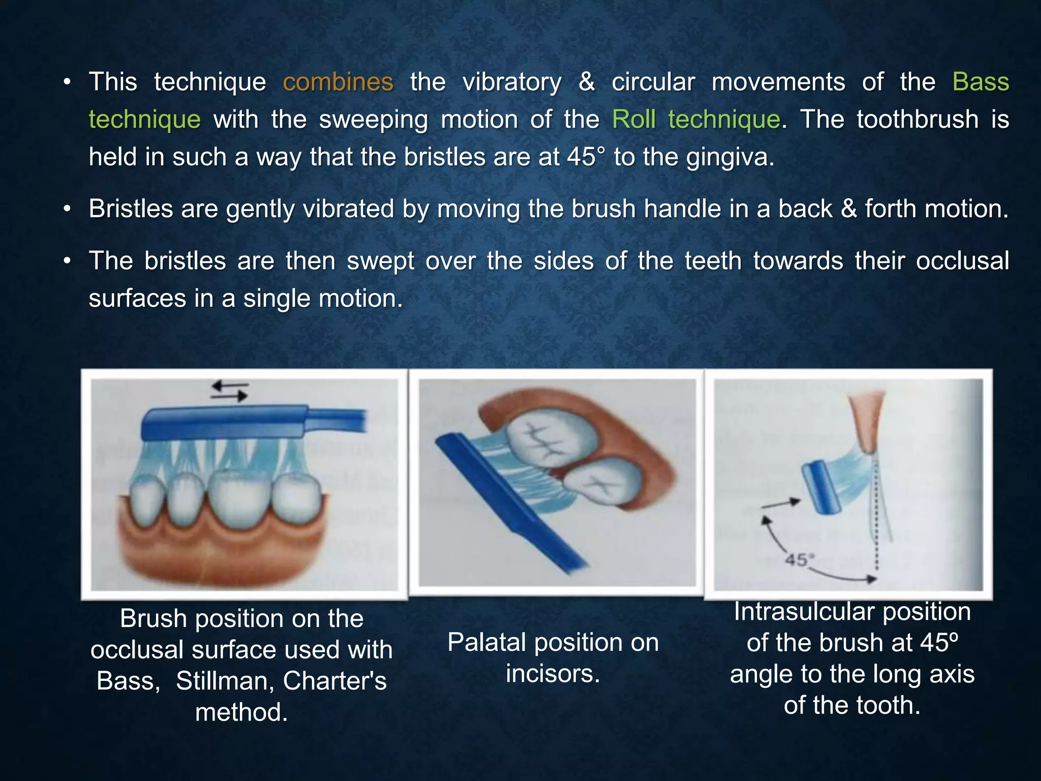 Brushing techniques | PPTX