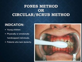 Brushing techniques | PPTX