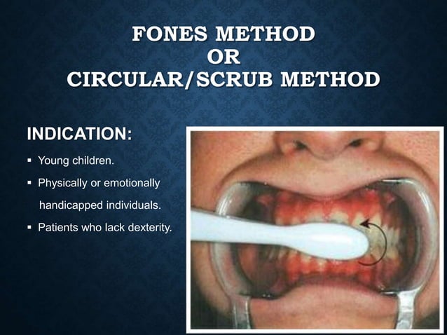 Brushing techniques | PPTX