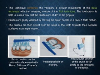Brushing techniques | PPTX