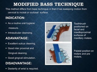 Brushing techniques | PPT