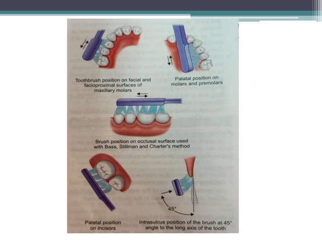 Brushing techniques | PPTX | Oral care | Personal Care