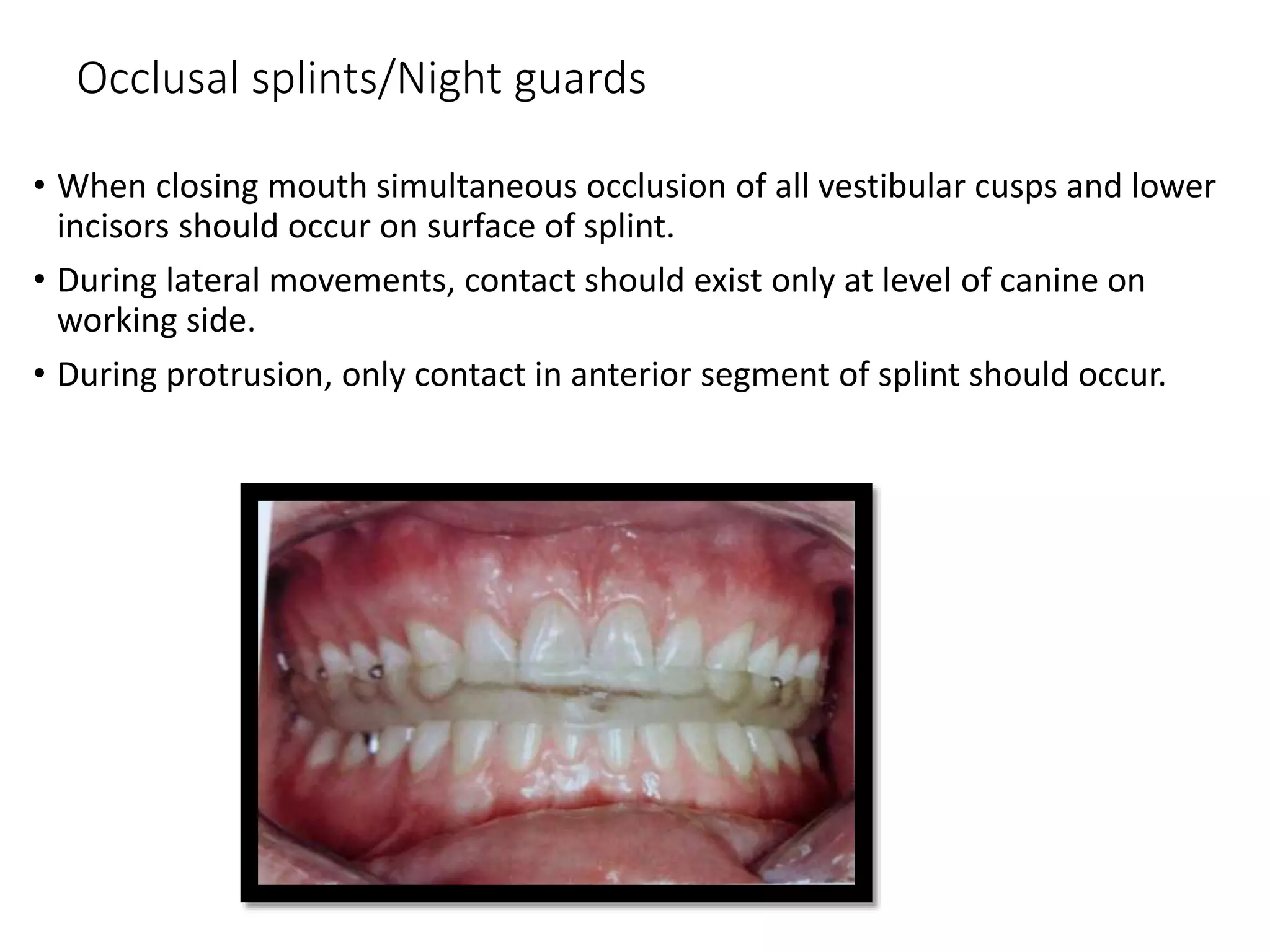 Bruxism and its effect on periodontium | PPTX