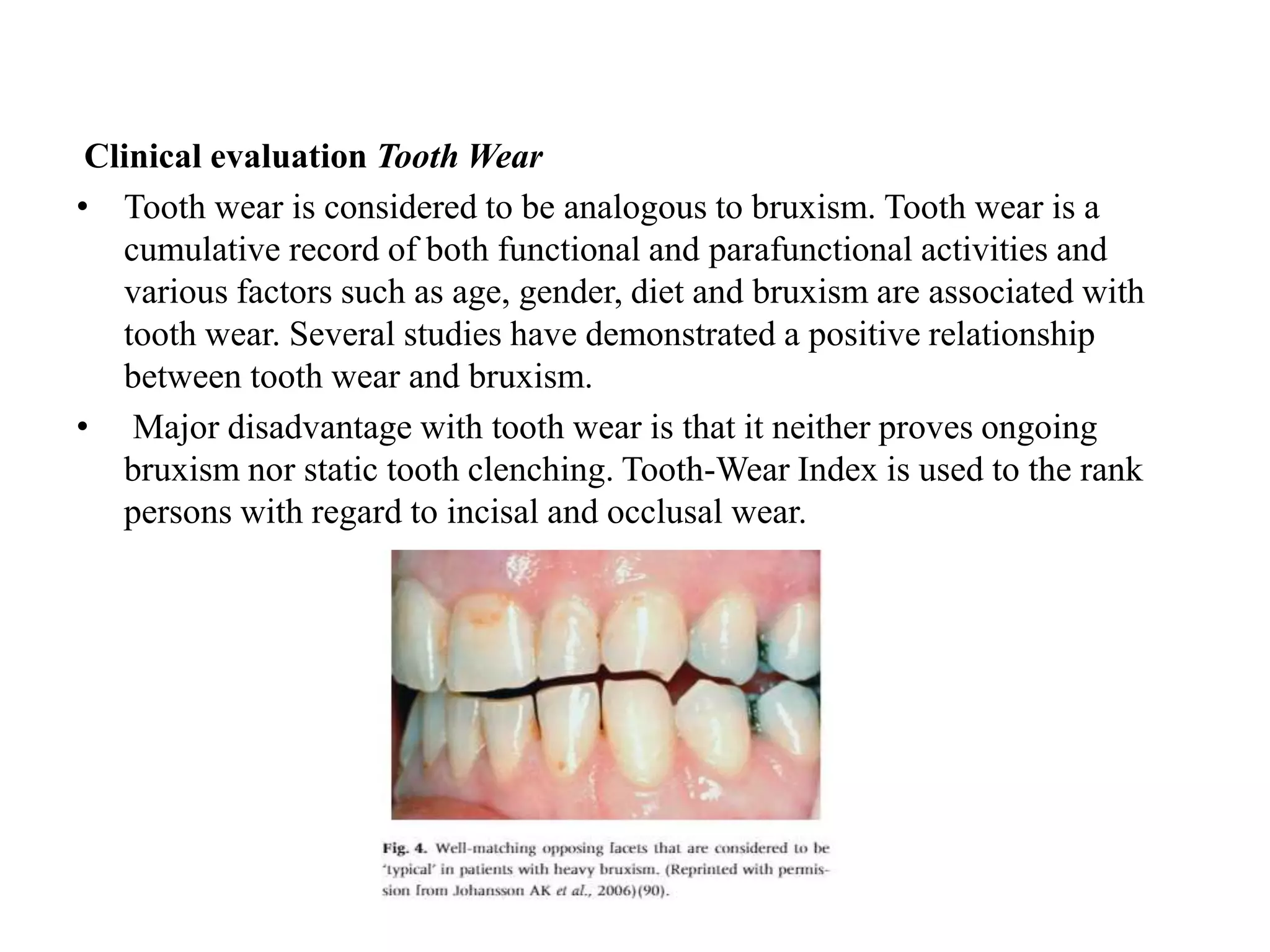 Bruxism and its management | PPTX