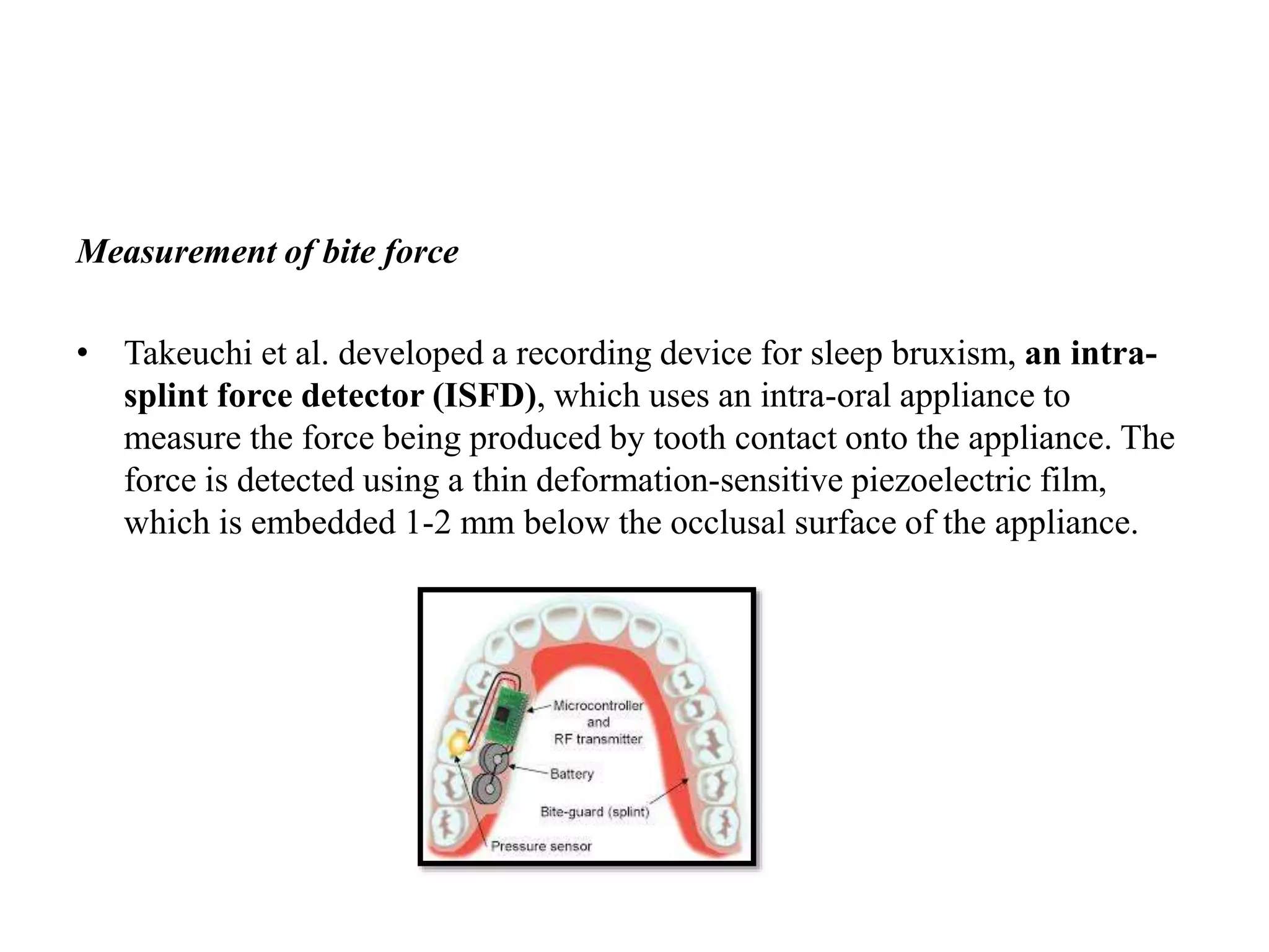 Bruxism and its management | PPTX