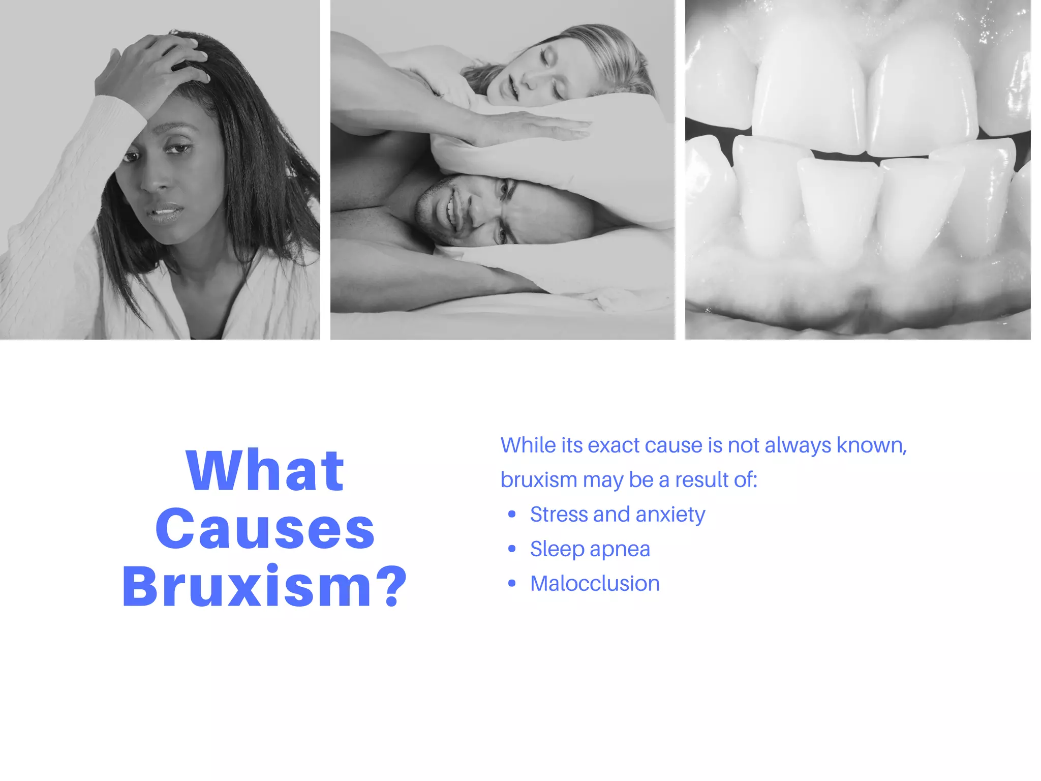 Bruxism The Causes Risks Treatment And Prevention Of Tooth Grinding