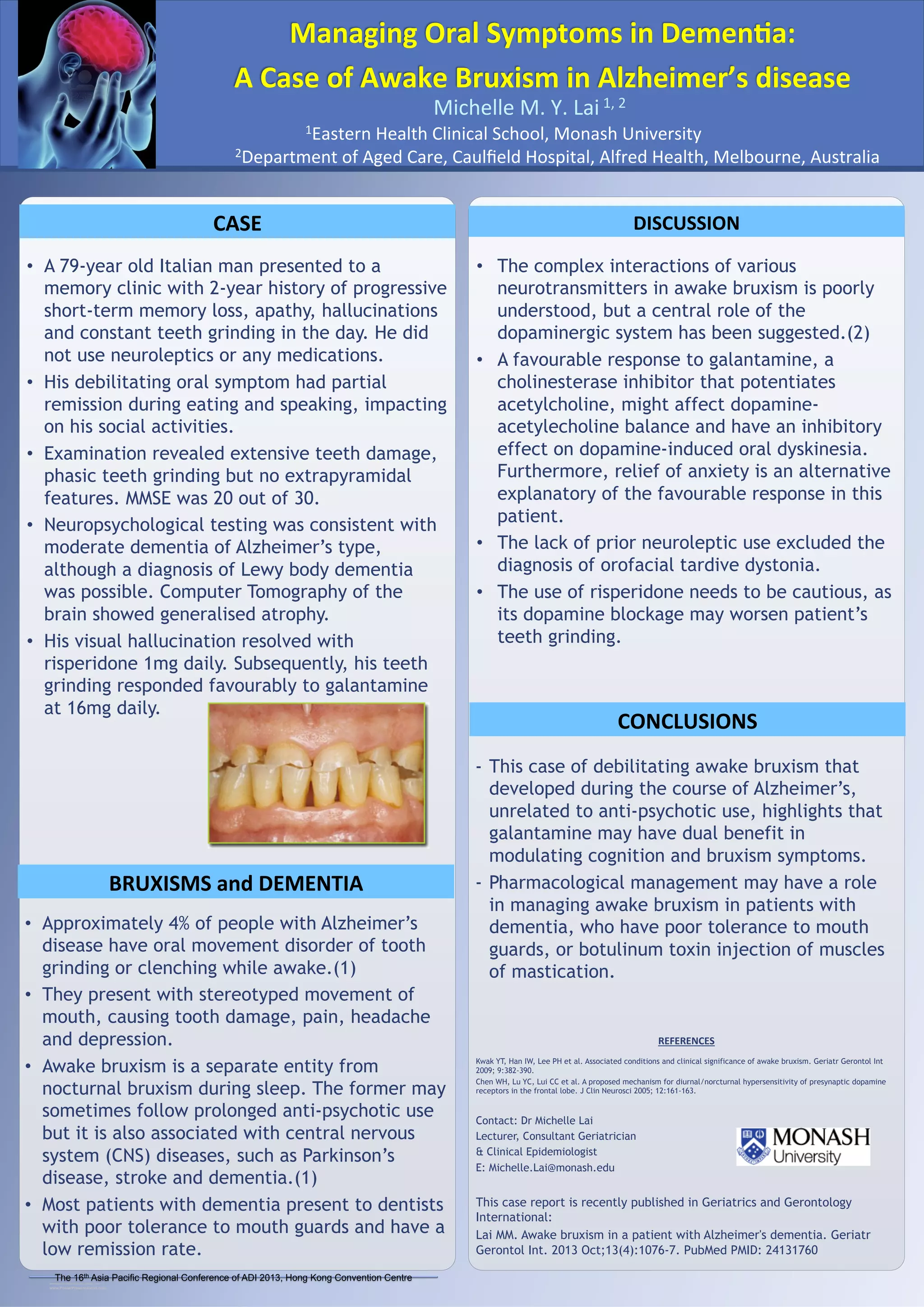 How to Manage Teeth Grinding (Bruxism) in Dementia? Alzheimer's Disease ...