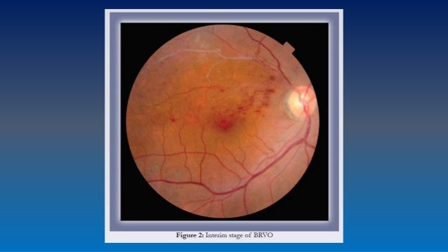 BRVO MANAGEMENT 2016