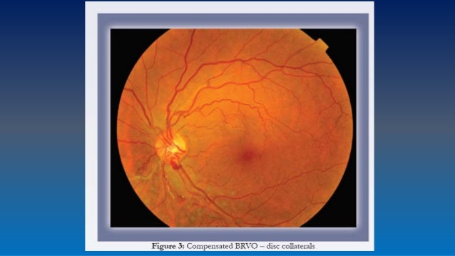 BRVO MANAGEMENT 2016