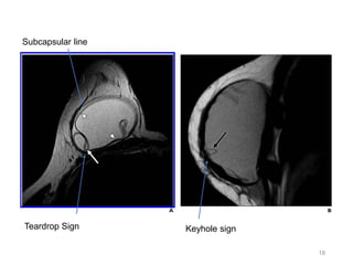 BR WI Others.pptx | Free Download