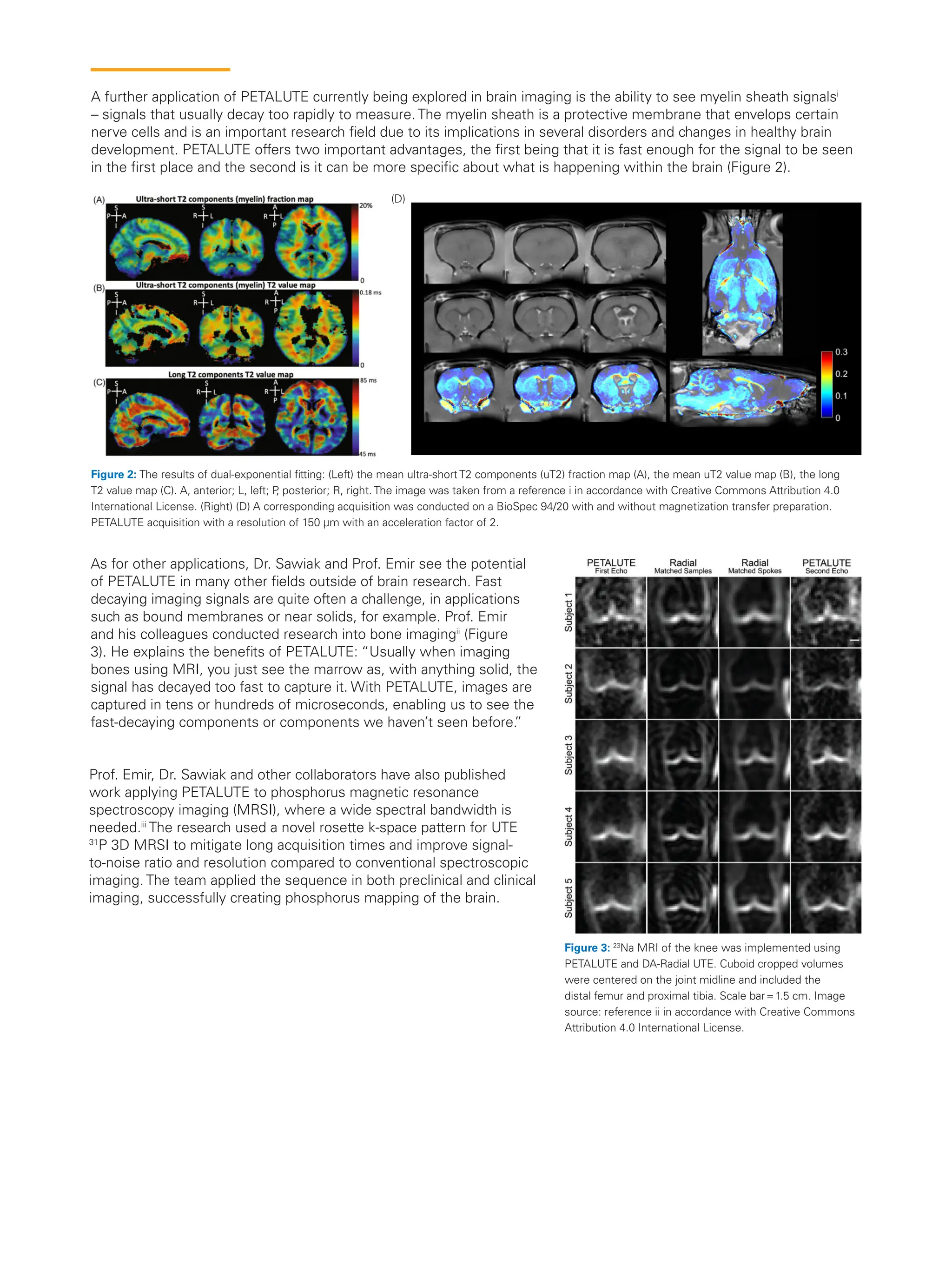 Modified Rosette Bridging the Gap Between Preclinical and Clinical ...