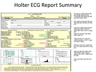 Đọc Holter ECG 24h | PDF