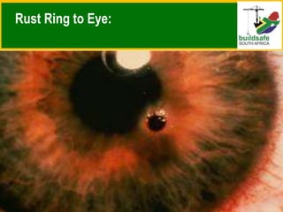 BSA - Eye Injuries 001.pptx