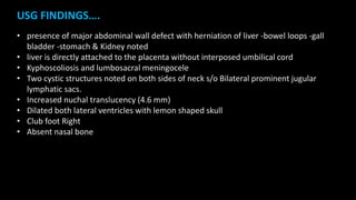 BODY STALK ANOMALY | PDF