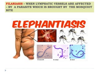 BSC nursing - LYMPHATIC SYSTEM notes.pptx