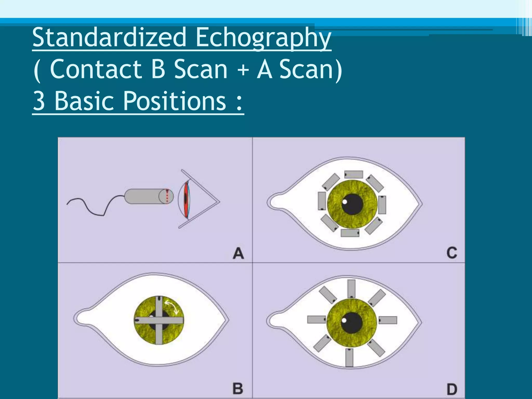 B scan | PPTX