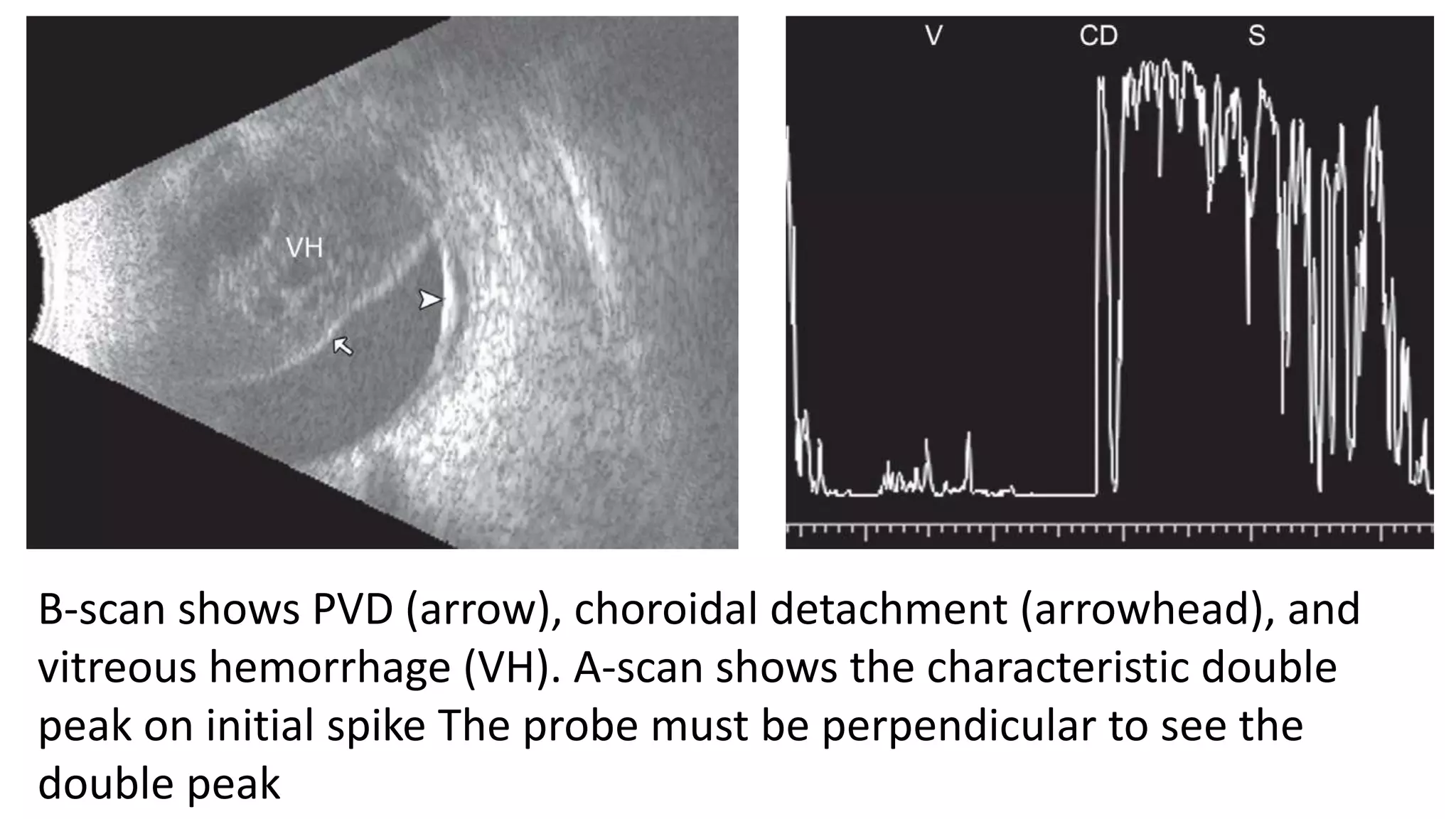 B scan | PPTX | Digital Audio | Computer Software and Applications