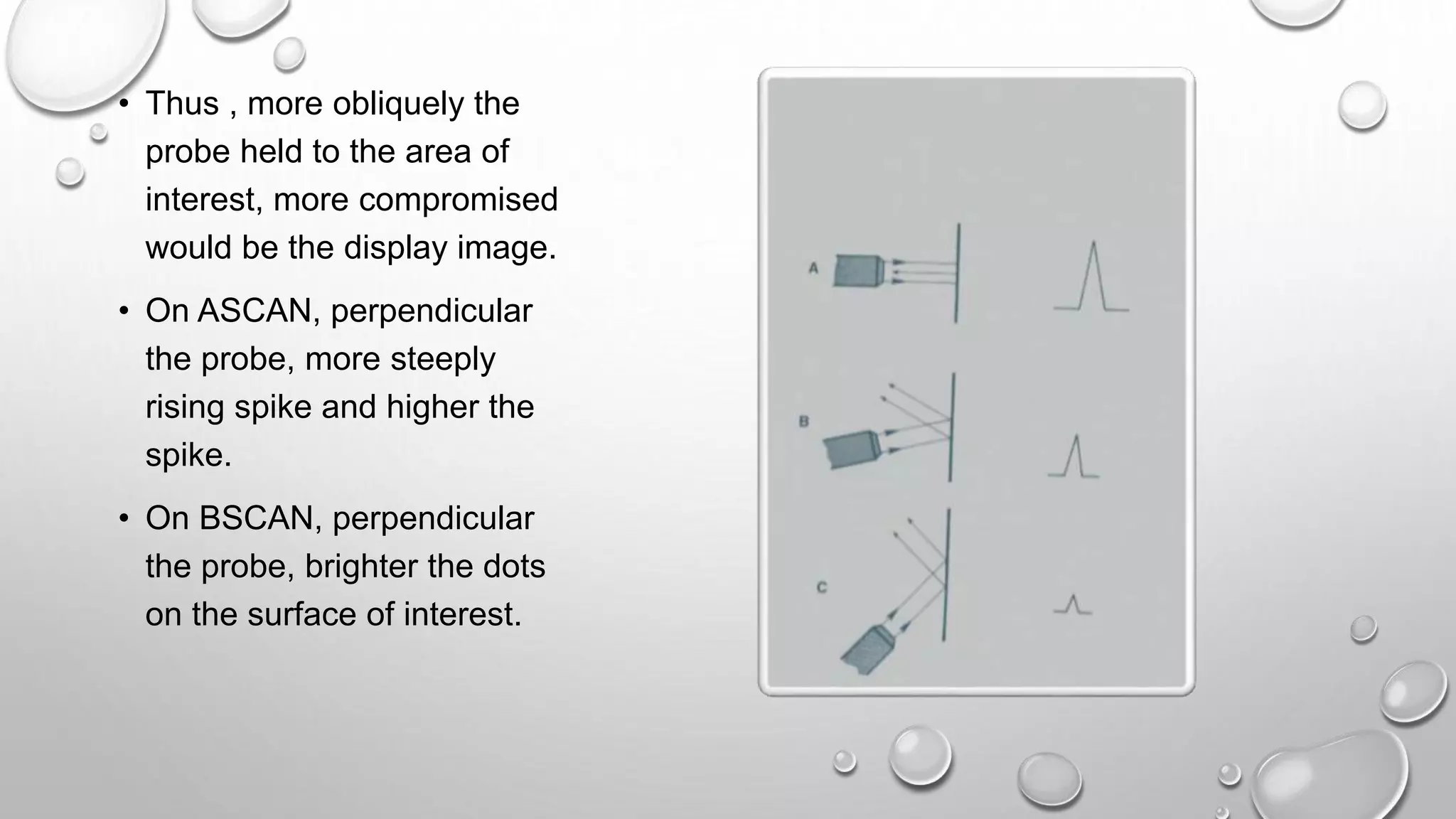 Ultrasound of eye - B scan | PPTX