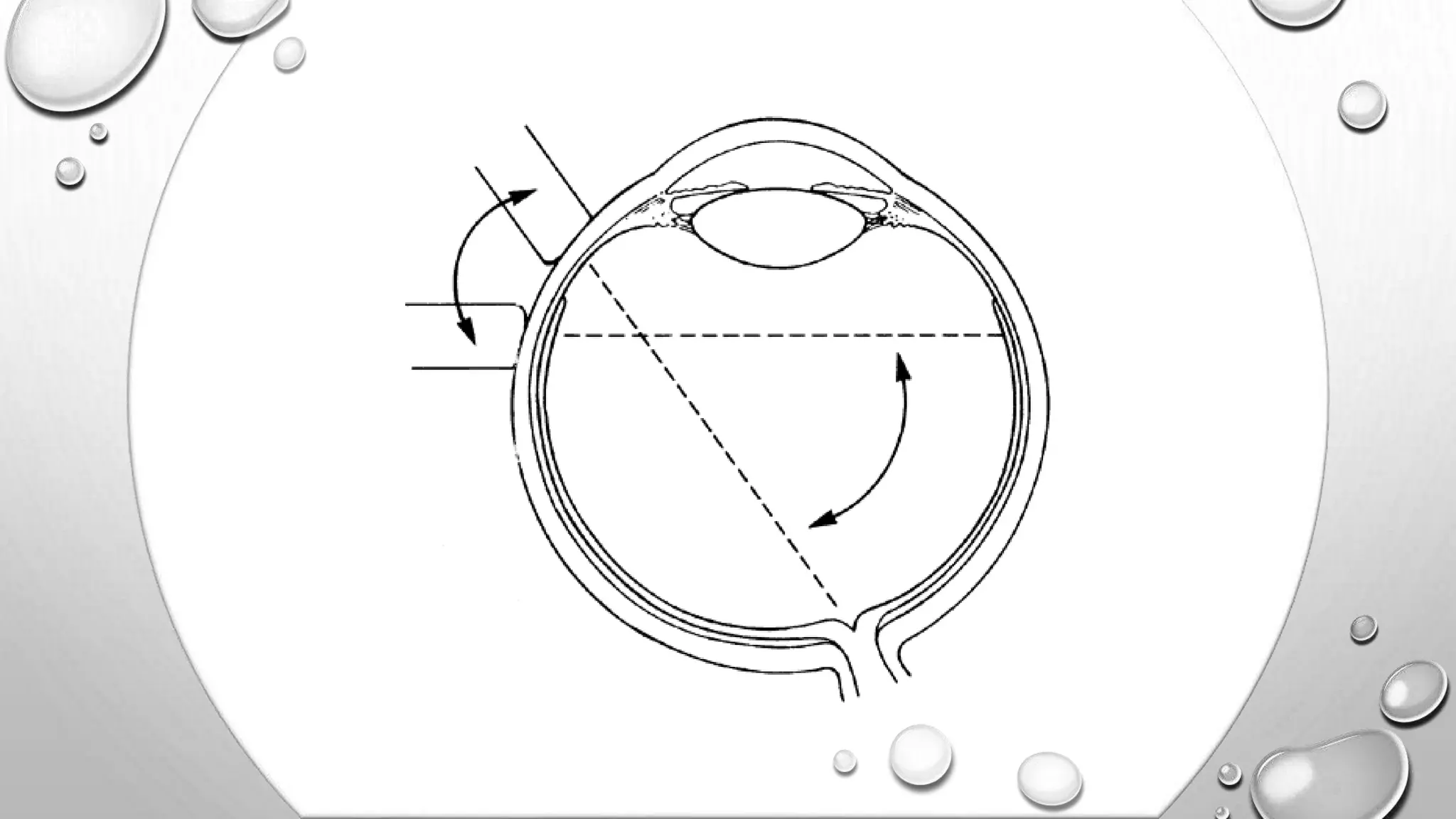 Ultrasound of eye - B scan | PPTX
