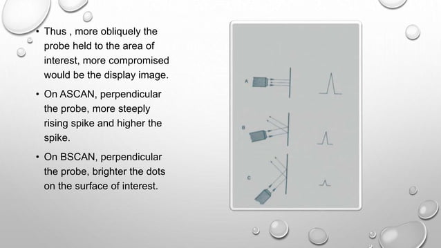 Ultrasound of eye - B scan | PPTX | Digital Audio | Computer Software ...