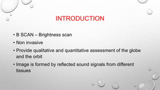 Ultrasound of eye - B scan | PPTX