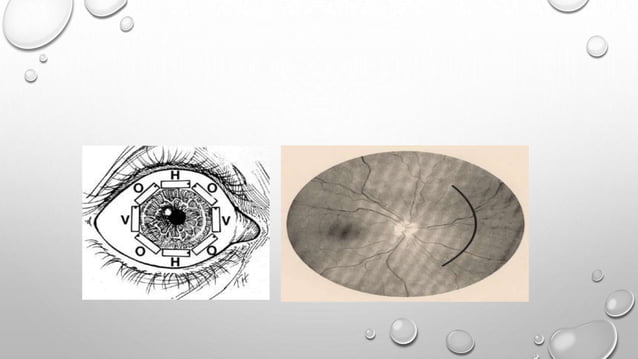 Ultrasound of eye - B scan | PPTX | Digital Audio | Computer Software ...