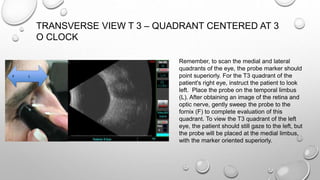 Ultrasound of eye - B scan | PPTX