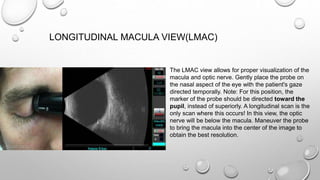 Ultrasound of eye - B scan | PPTX