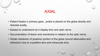Ultrasound of eye - B scan | PPTX